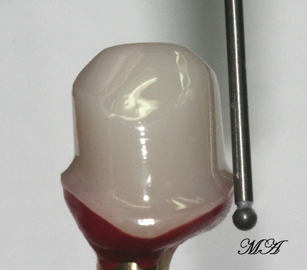 Taktiler Scan / Tips & Tricks (Scan mit Renishaw) | DENTALLIGENT | Blog