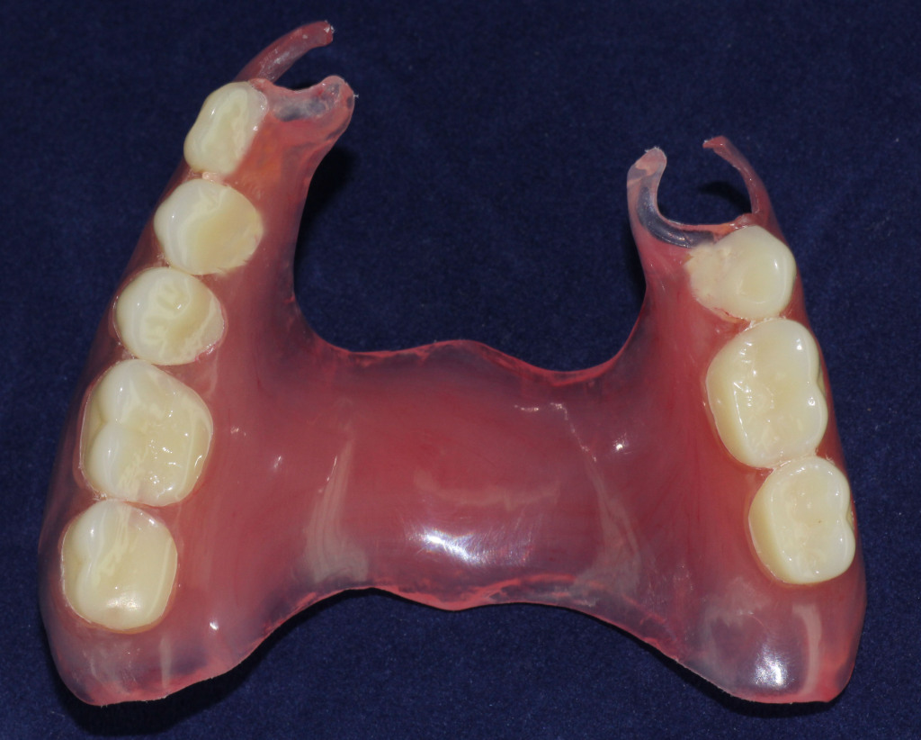 Valplast Prothesen aus Nylon | DENTALLIGENT | Blog