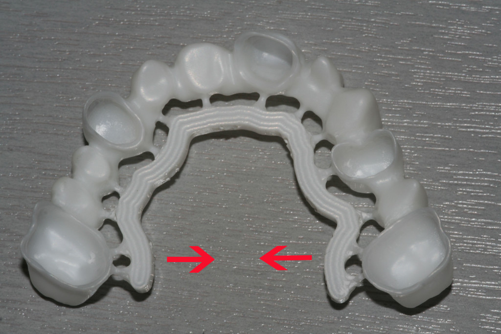 Sinterstege / Sinter-Bars (Zirconium) | DENTALLIGENT | Blog