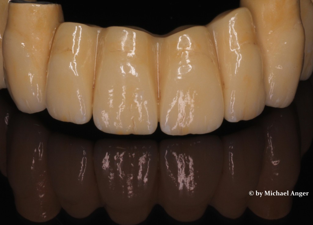 NEM & VMK | DENTALLIGENT | Blog