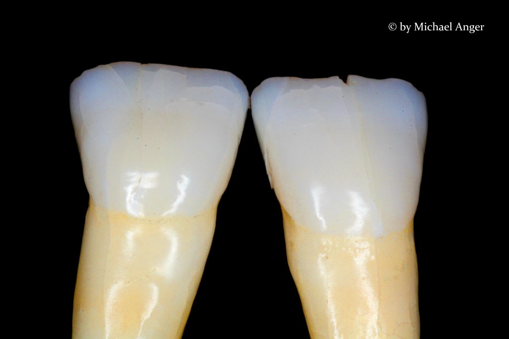 Natürliche Zähne / Naturals | DENTALLIGENT | Blog