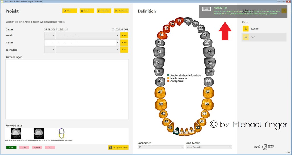 A neues Exocad im Win8_Design 3. Workflow-Hotkey | DENTALLIGENT | Blog