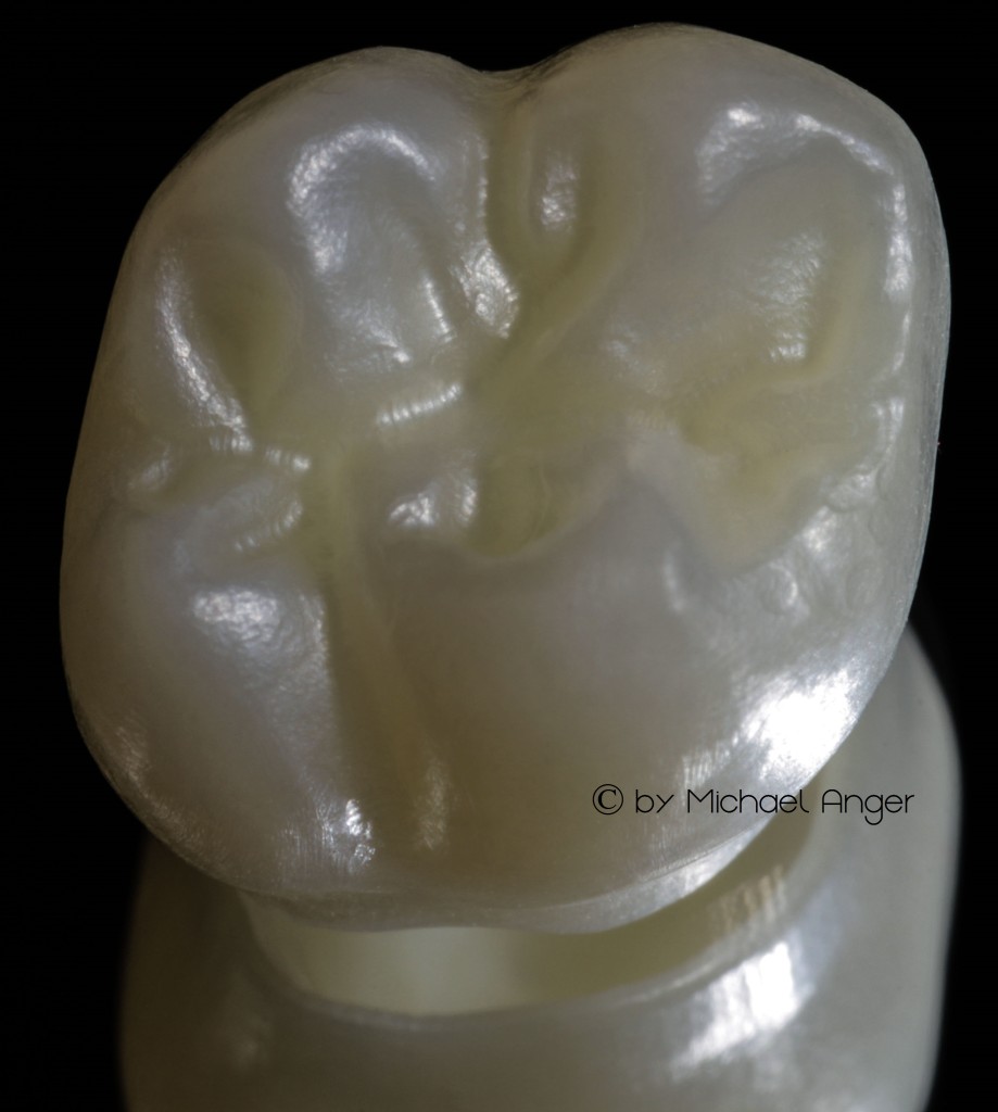 New high translucent zirconium | DENTALLIGENT | Blog