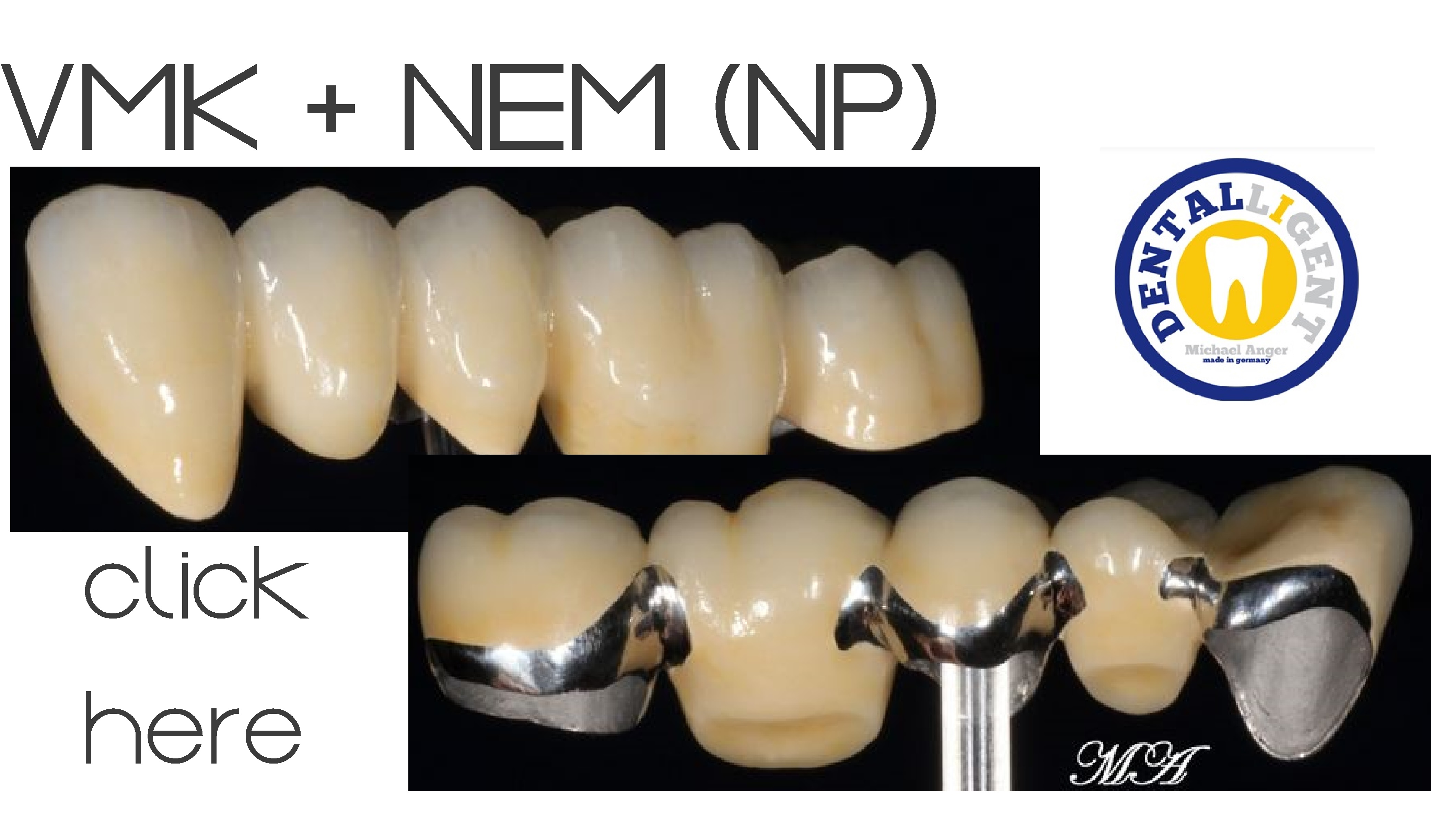 VMK + NEM Übersicht | DENTALLIGENT | Blog